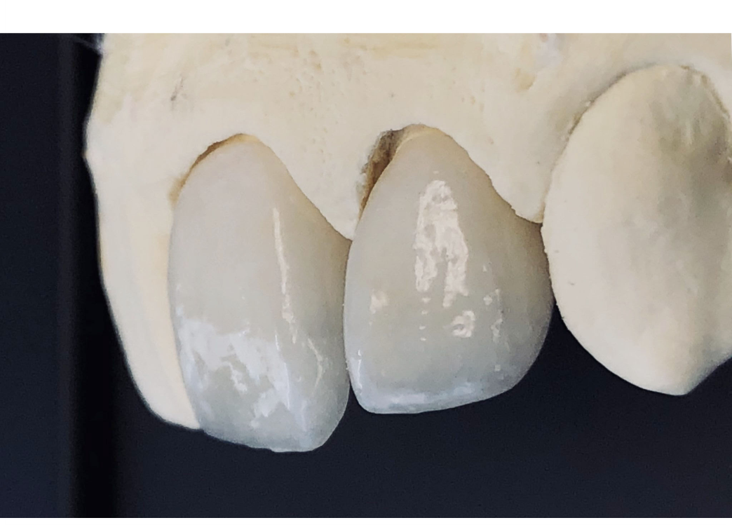 TeethFast